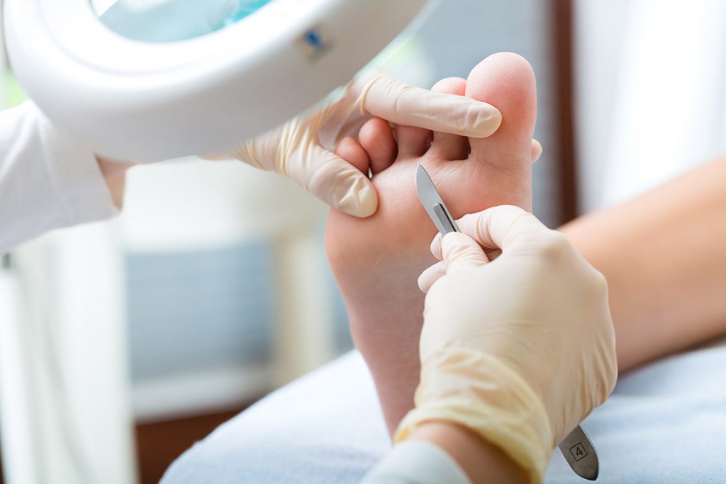 Podiatrists and Scalpel Cuts – Understanding the Risks and How to ...